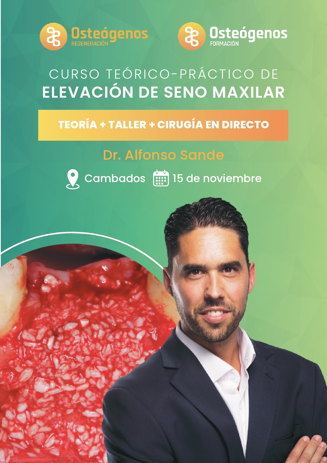 ELEVACIÓN DE SENO MAXILAR :: Centros C3D